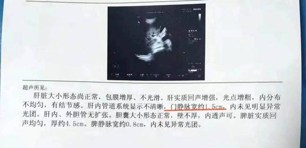b超显示实质性包块严重吗截图