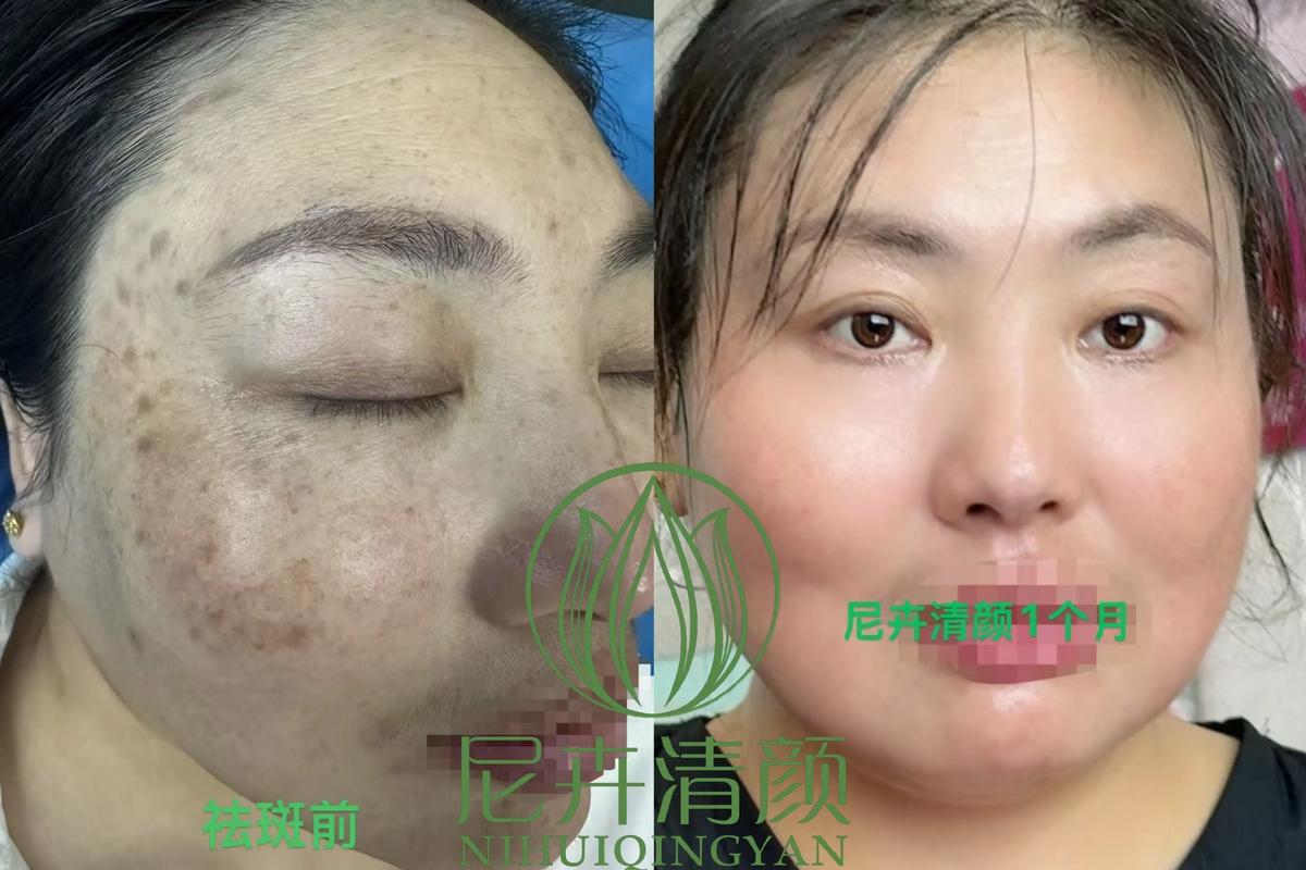 手机屏幕亮斑修复图标