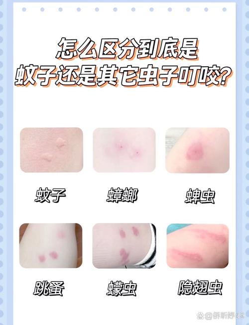 昆咬什么意思图标
