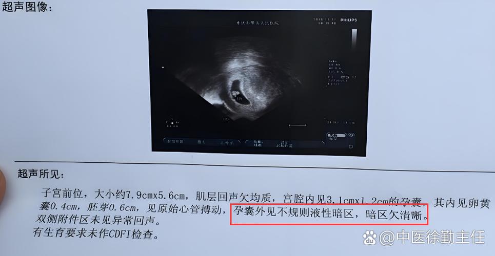 怀孕六周只看到暗区图标