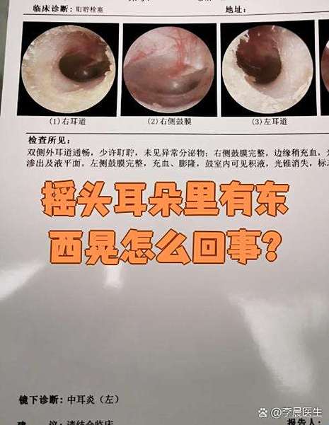 耳朵里像有东西晃来晃去响截图