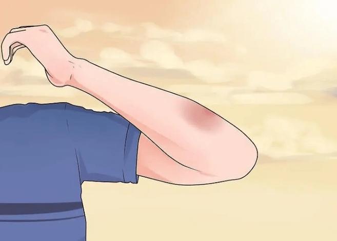 淤青漫画图片截图