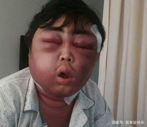 脸上被打后的图片图标