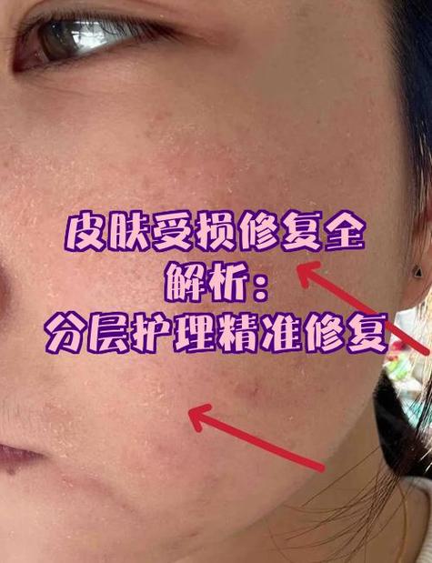 皮肤修复周期是多久截图