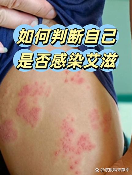 艾滋病毒的发现者截图