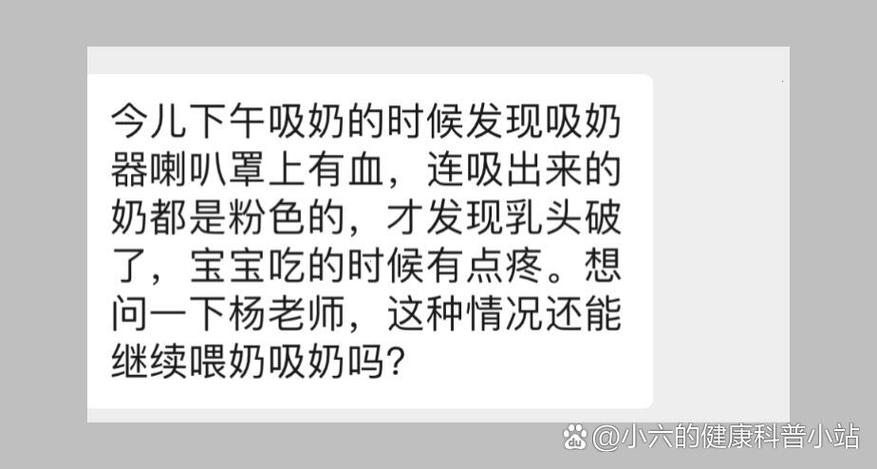 吸奶器吸出带血浓稠物图标