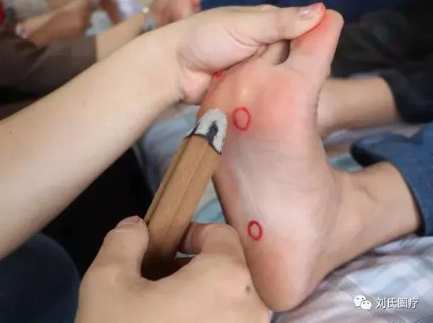 梅花灸的作用图标