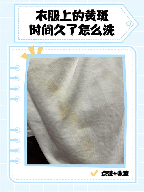 衣服发霉洗衣液能洗掉吗图标