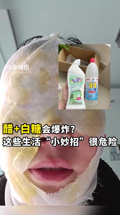 白糖加什么会引起爆炸图标