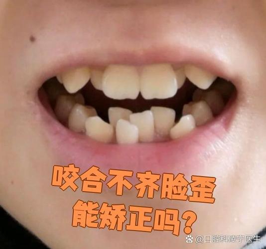 牙齿缺失导致脸歪还能恢复吗图标