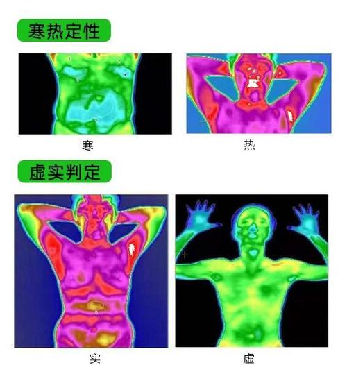热成像为什么不清晰图标