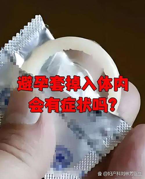 套子掉内了一般几天能发现图标