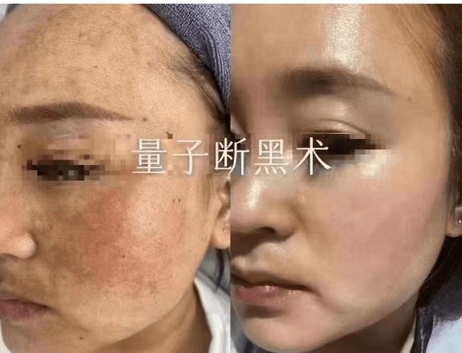 屏幕出现黑斑但触摸正常图标