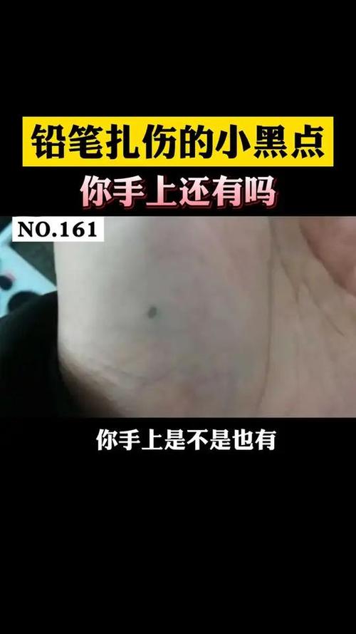 铅笔扎的黑印当时能去除吗截图