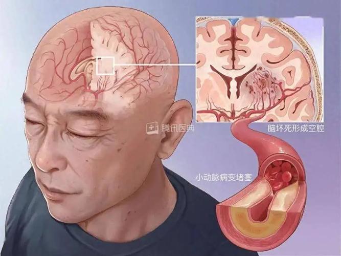 性为什么伤害大脑图标