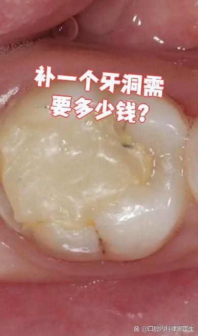 现在补一颗牙多少钱图标