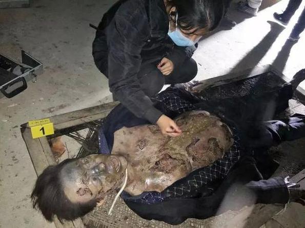 金关法医病尸检视频截图