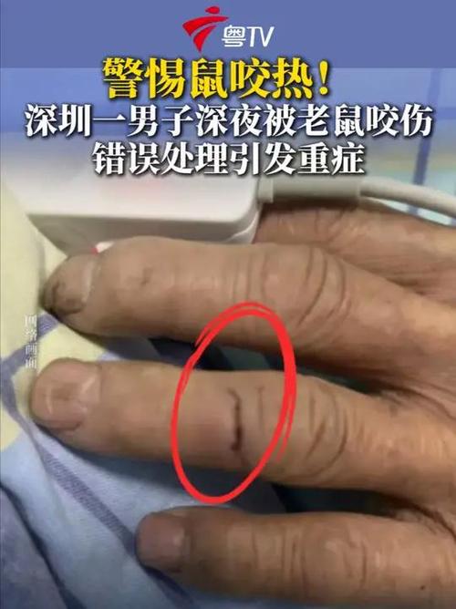仓鼠咬了我后3天后死了缩略图