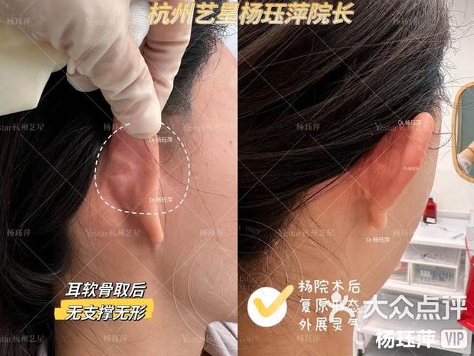 耳机音质突然变差图标