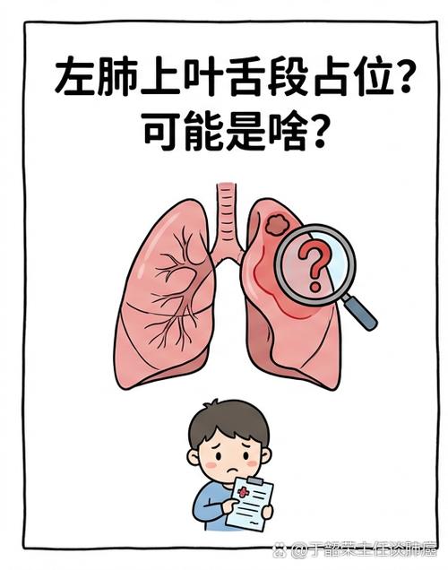 肺部占位多大是恶性可能截图