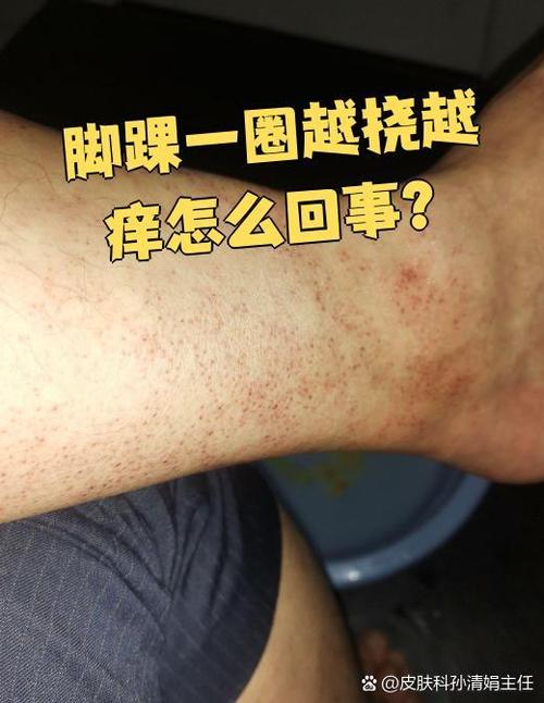 女人脚痒痒怎么回事图标