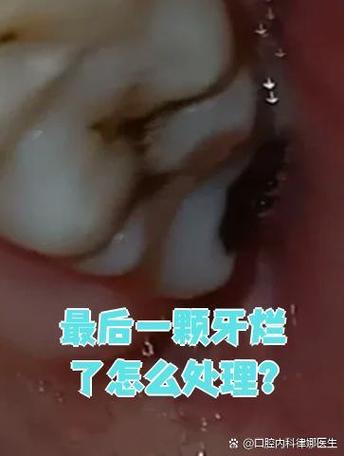 最后一颗牙齿烂了图标
