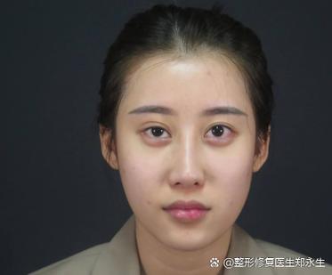 大小眼怎么自己调整截图