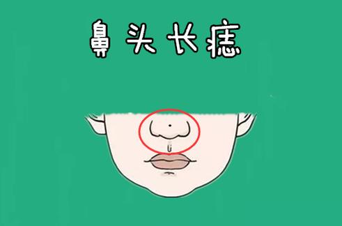 女人晚年享福的痣截图