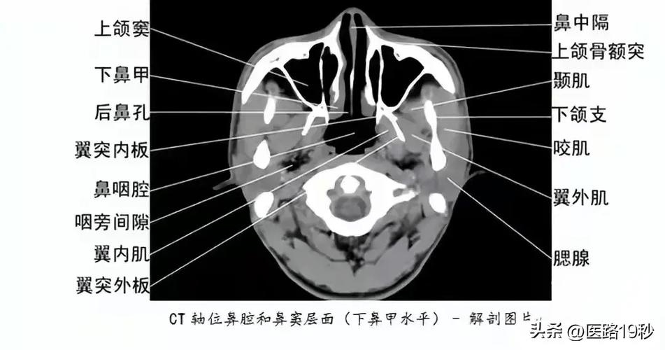 ct片扫描成电子版图标