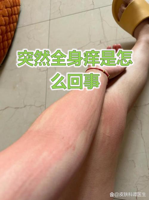 全身痒痒的怎么回事图标
