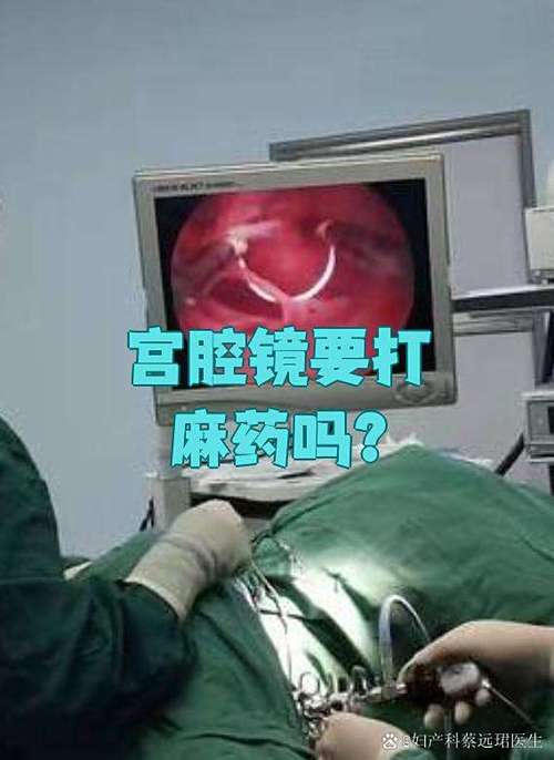 做宫腔镜要住院吗图标
