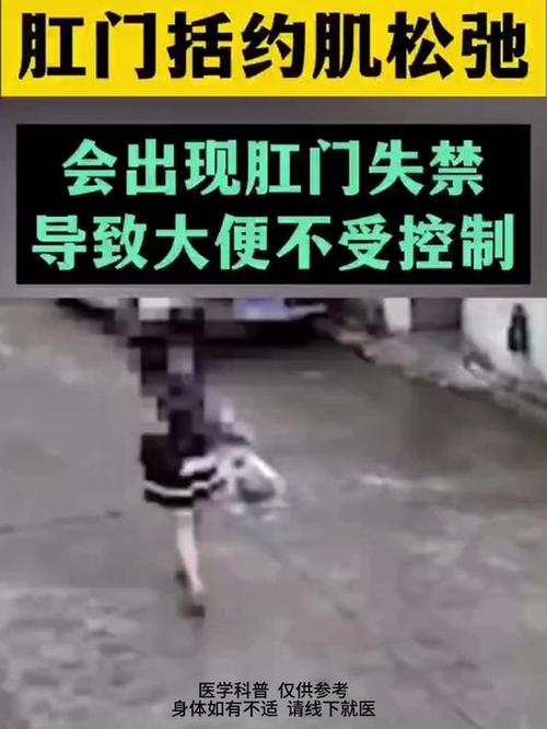 拳头进入肛门后肛门松弛怎么办图标