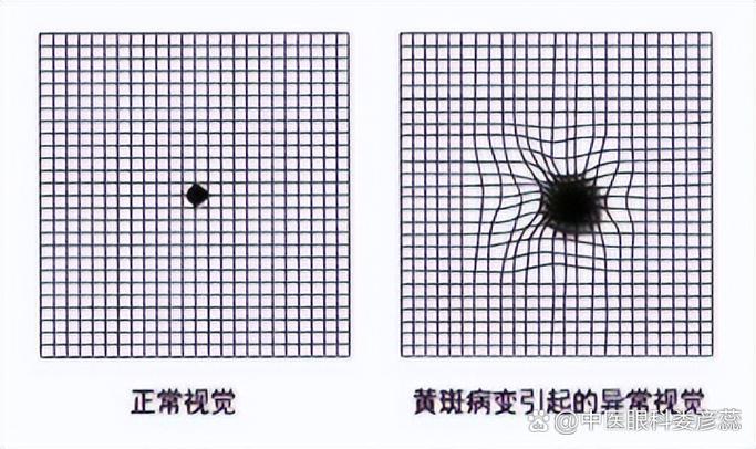 恢复正常视力截图