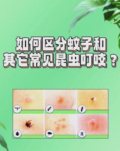 床上有虫子咬人很痒是什么虫截图