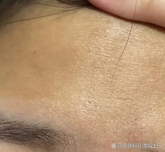 脸发黄是啥情况图标