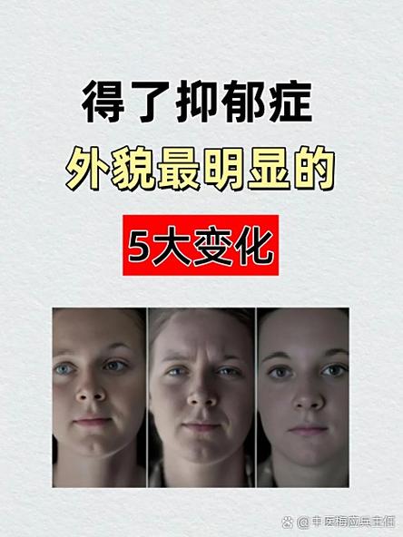 得了抑郁症会怎么样图标