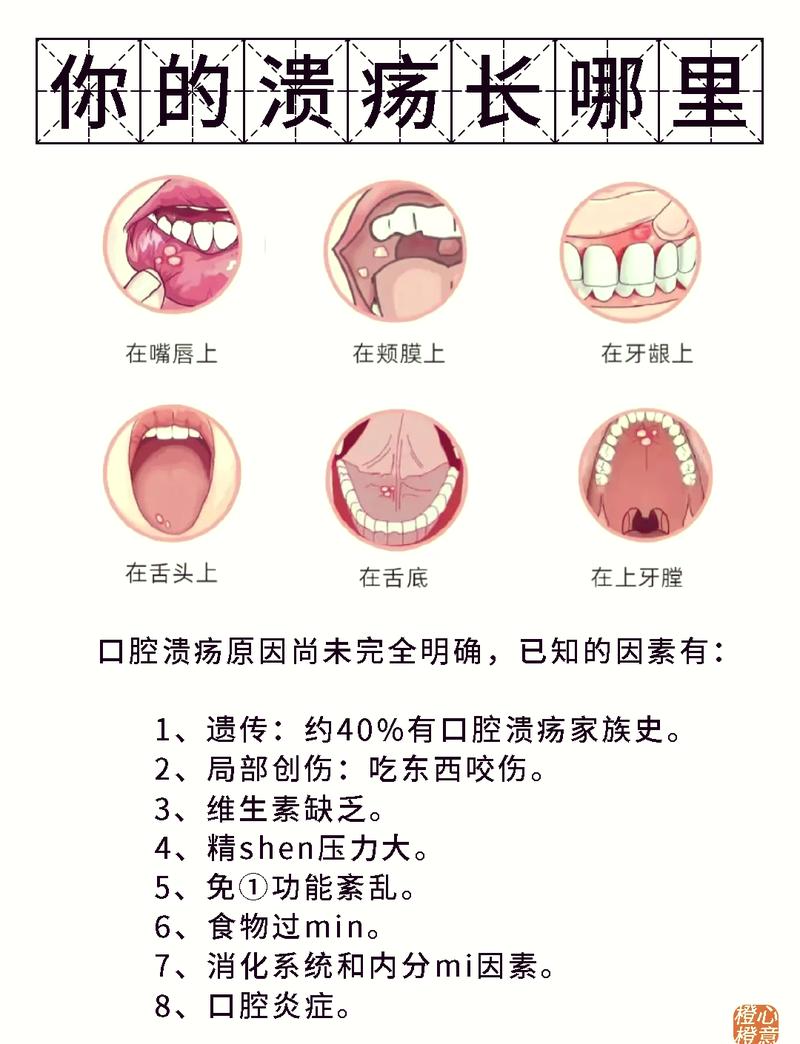 烂嘴的治疗方法图标