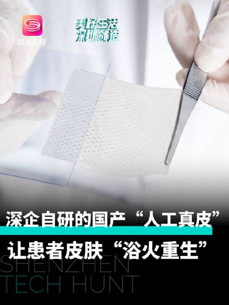 真皮掉漆如何修复图标