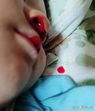 睡眠少流鼻血图标