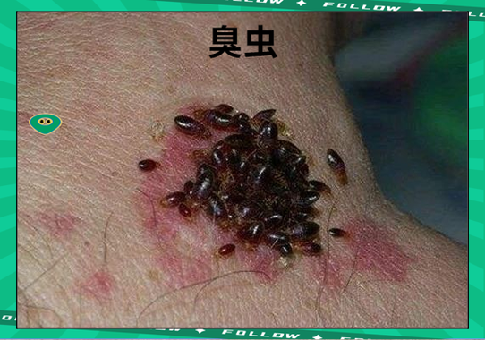 床上有臭虫图片图标