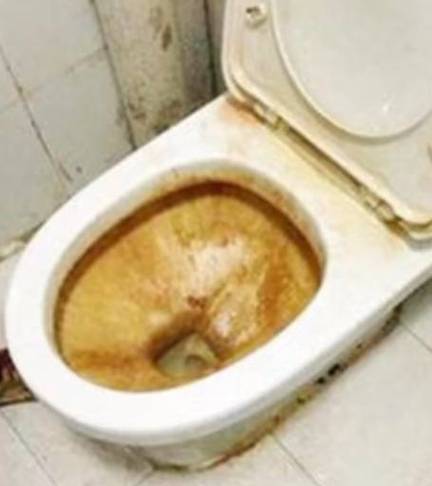 马桶结垢严重怎么处理