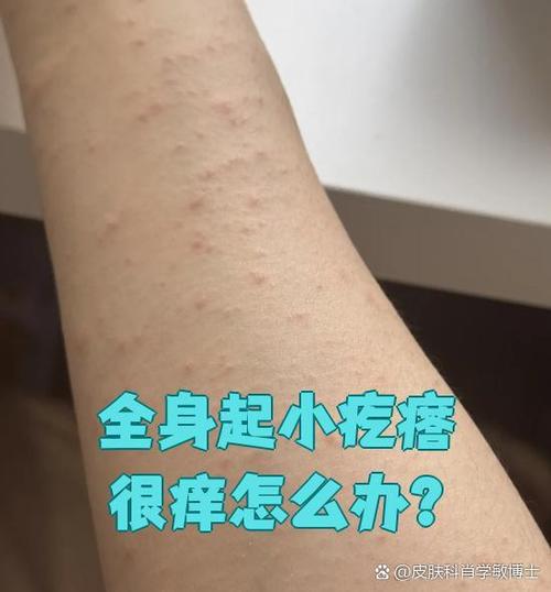 脚背上起了好多小疙瘩特别痒图标