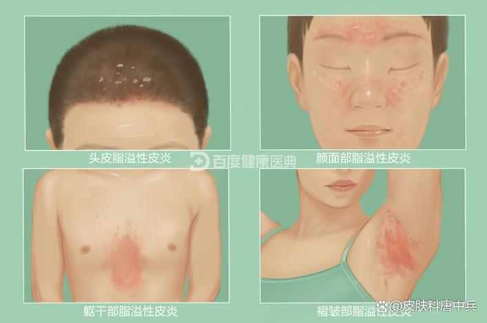 百度皮肤病图片识别图标