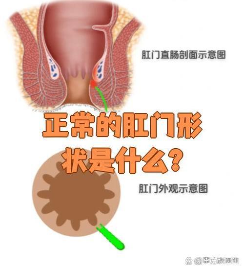 健康的肛门