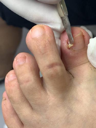 这次修脚的我在修脚的坏了