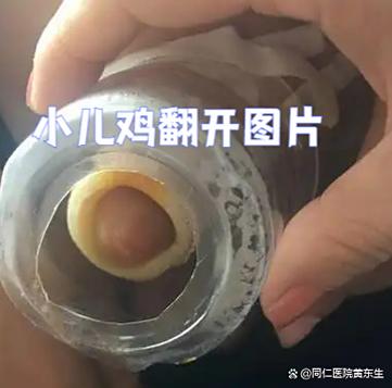 吃男人鸡有什么好处和坏处吗截图