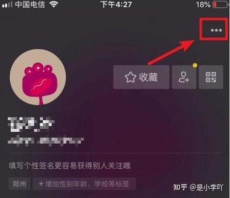 一点进主页就是橱窗怎么设置截图