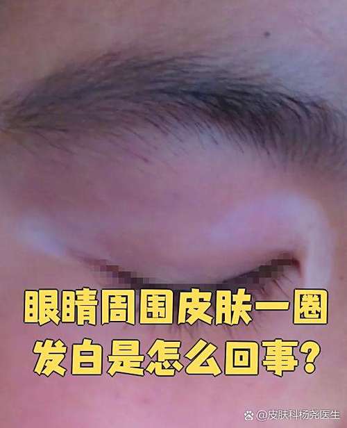 消除白圈的方法图标