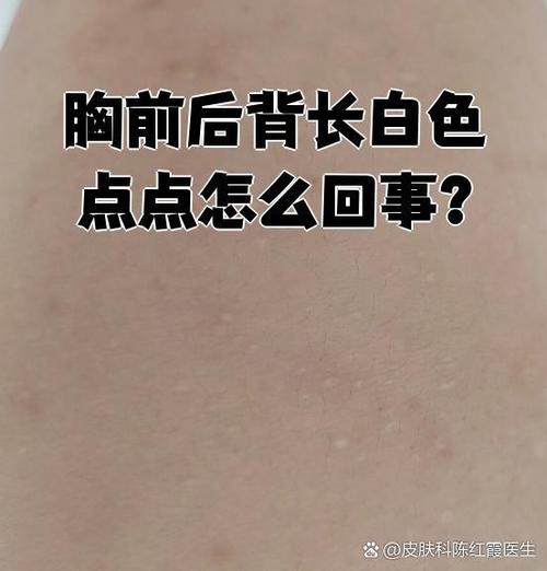 后背有一粒一粒小白点