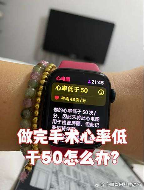 静态心率50有什么问题图标